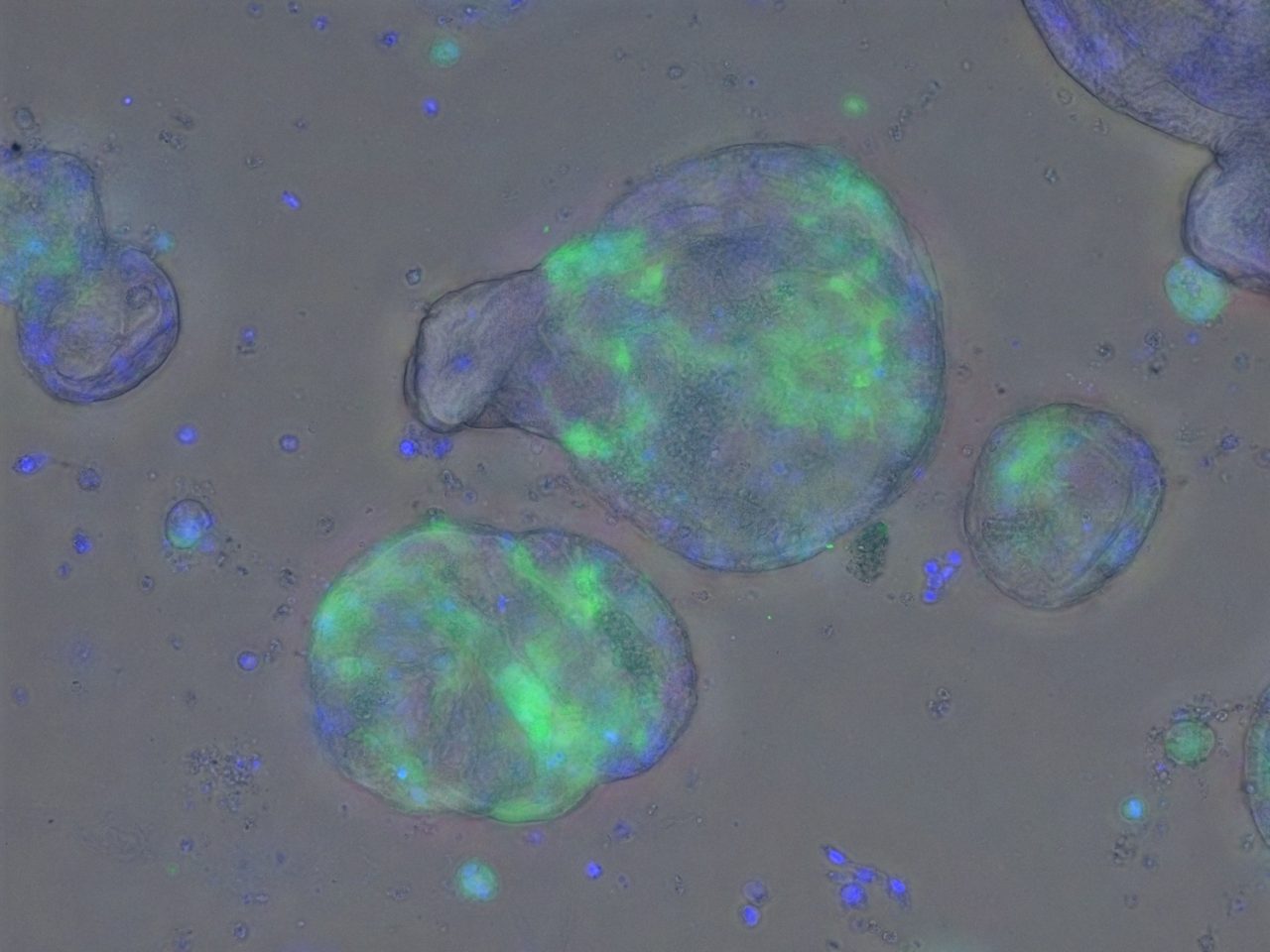 The Andres Lab | Oregon Health & Science University